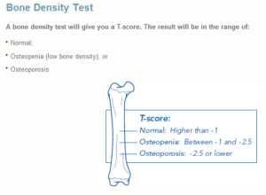 Understanding bone density tests can help prevent further problems.