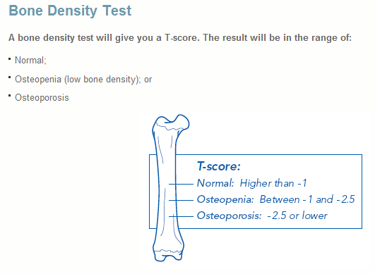 Understanding Bone Density Tests Can Help Prevent Further Problems